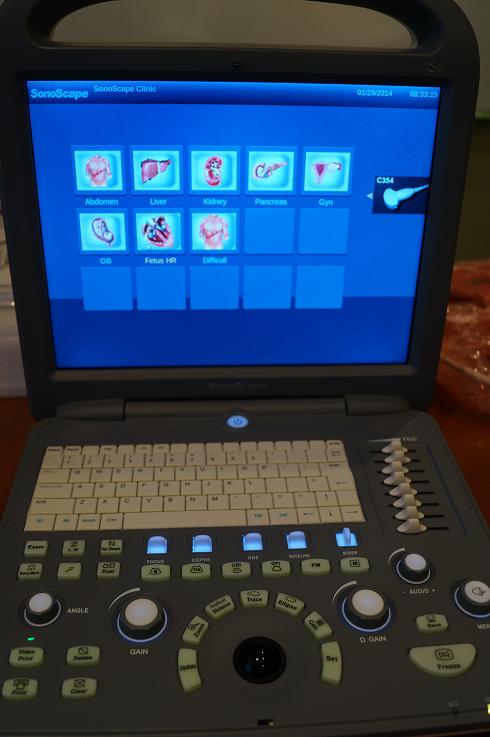 Sonoscape S2 Portable Color Ultrasound Machine for Sale - Used Hospital ...